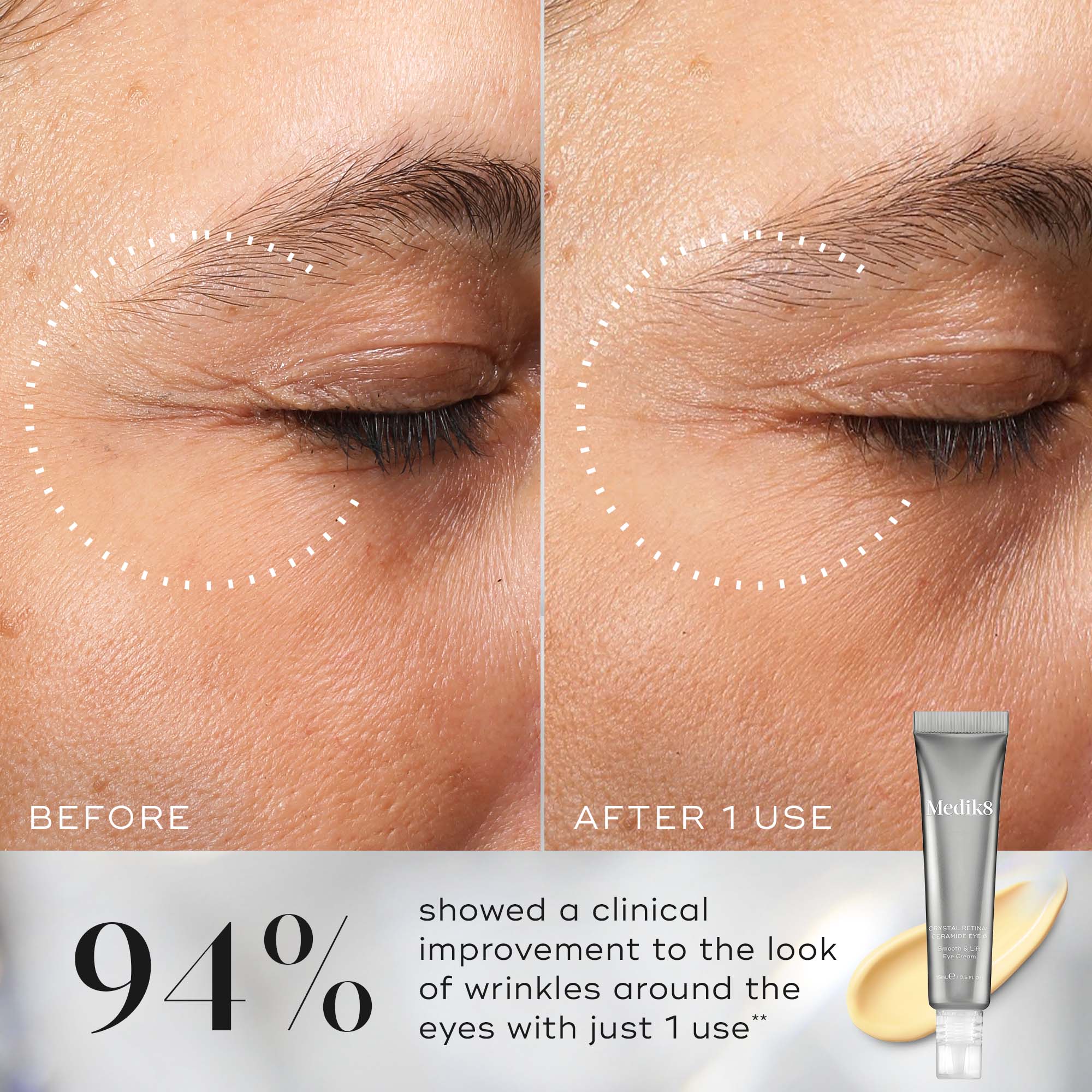 Crystal Retinal Ceramide Eye | Vitamin A Serum – Medik8